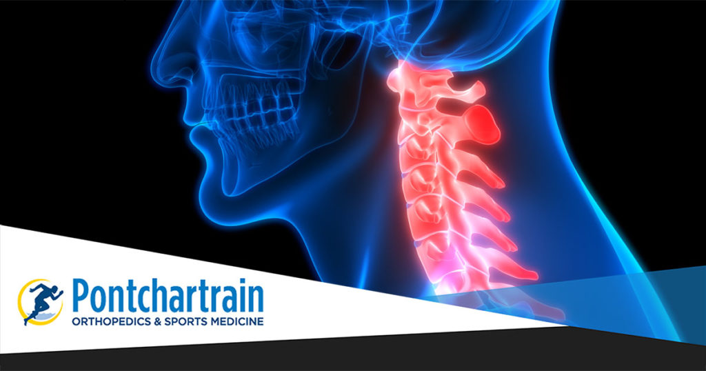Cervical Radiculopathy - Pontchartrain Orthopedics & Sports Medicine