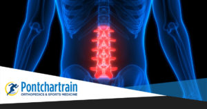 Lumbar Radiculopathy - Pontchartrain Orthopedics & Sports Medicine