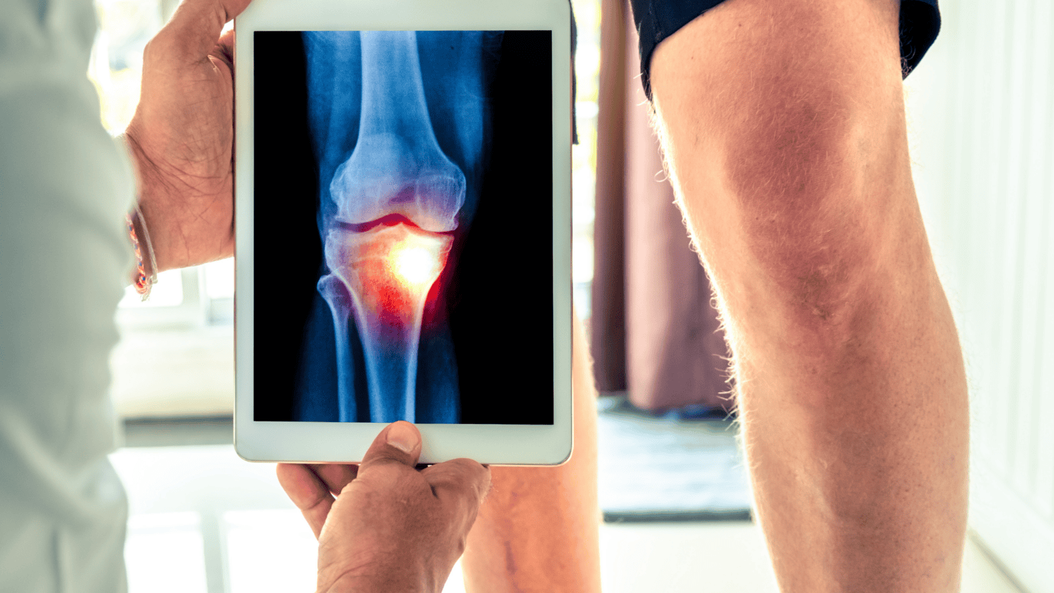 Early Warning Signs of Osteoarthritis - Pontchartrain Orthopedics ...