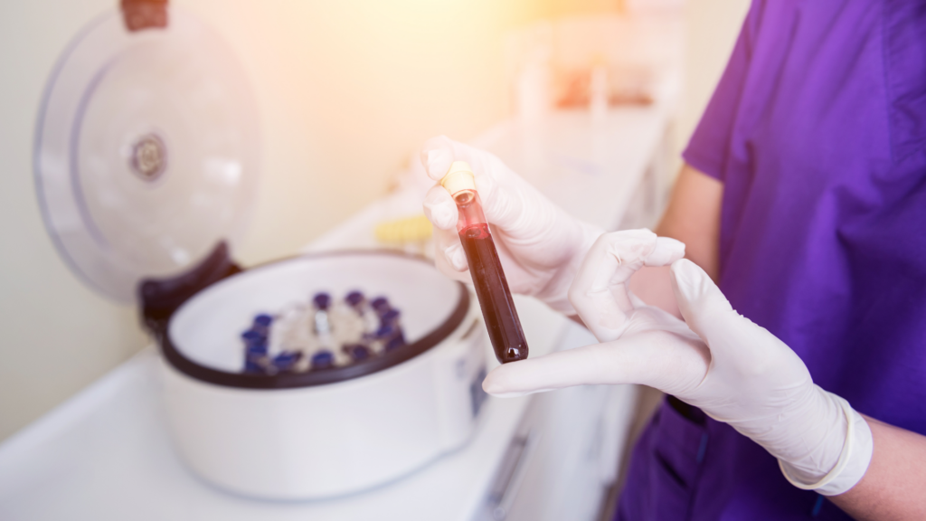 Platelet-Rich Plasma Therapy: How it Works - Pontchartrain Orthopedics ...