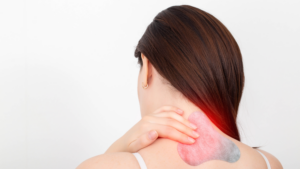 Understanding Myalgia: Causes, Treatments, and Prevention ...