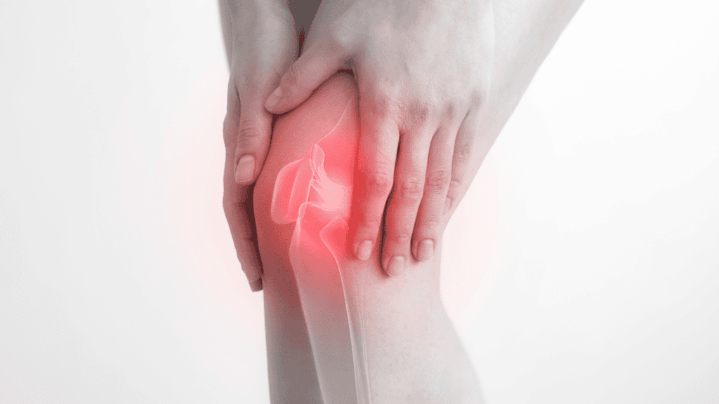 ACL Injuries: Causes, Treatment, and Recovery - Pontchartrain ...
