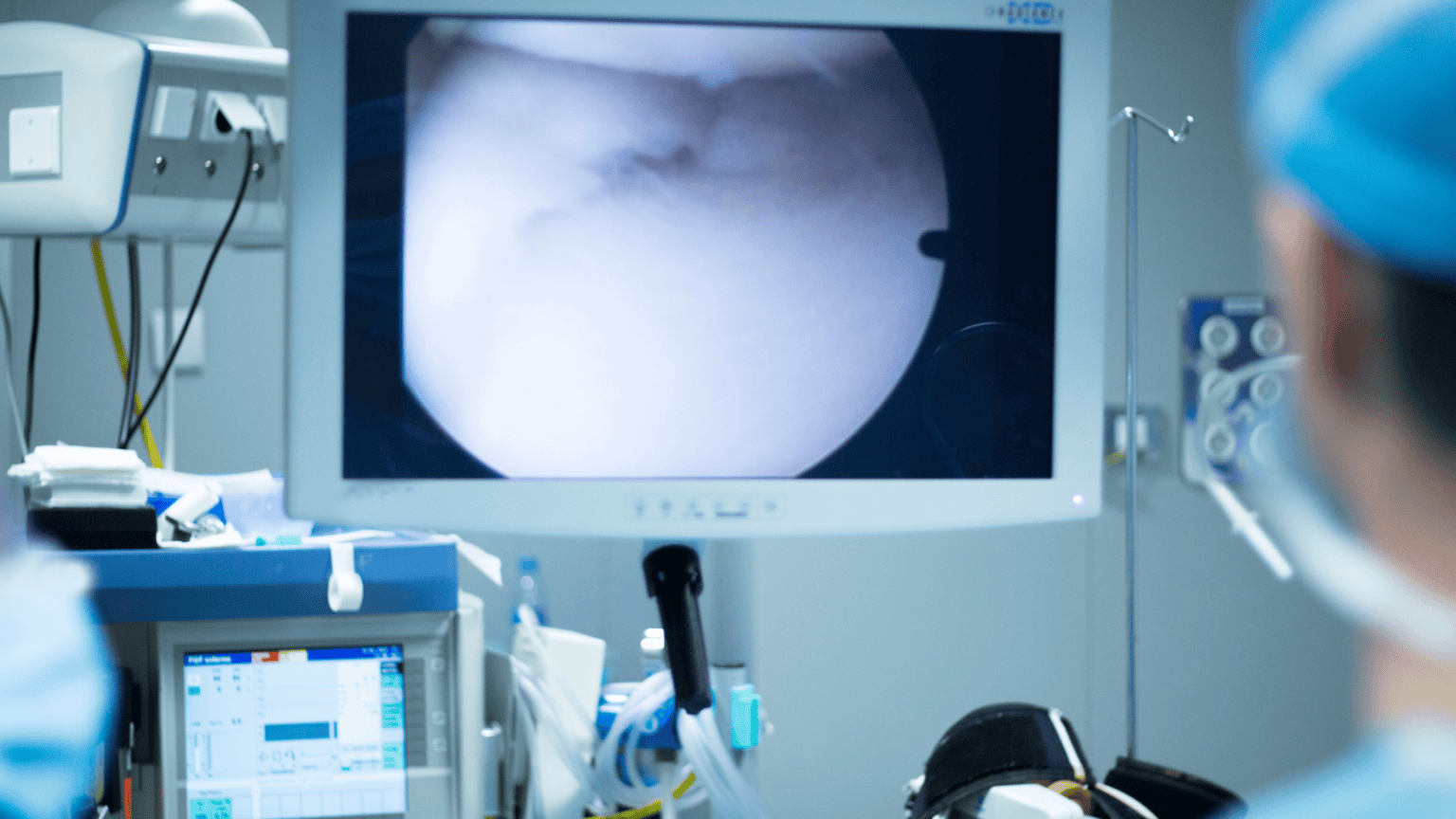 Things You Need to Know About Arthroscopic Surgery - Pontchartrain ...